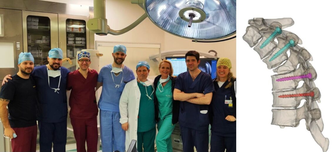 Cade dalle scale, al Di Venere speciali mascherine vertebrali 3D